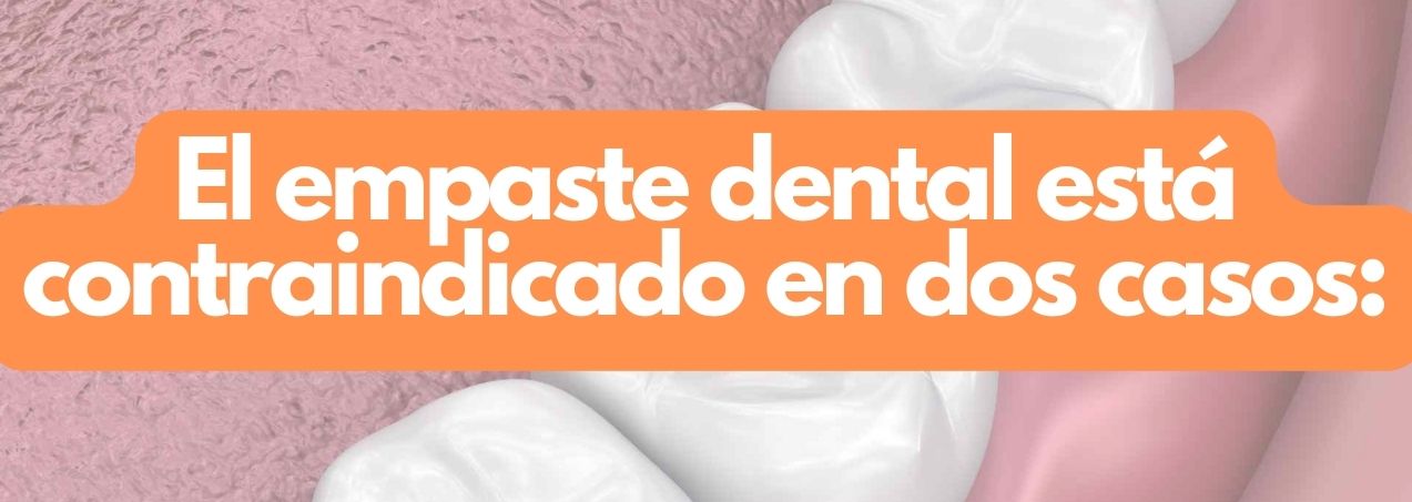 ¿En qué consiste un empaste dental? – Especialistas